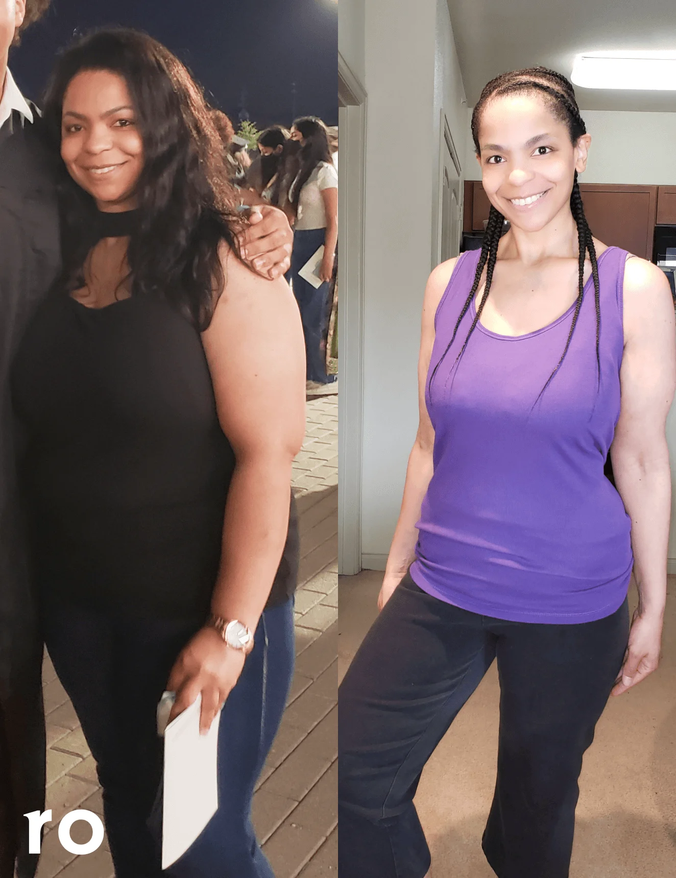 4 Zepbound Before and After Stories From Real Patients | Ro