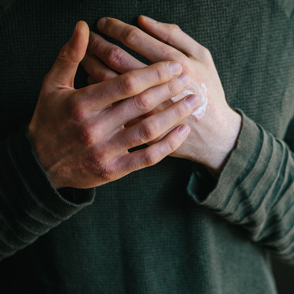 Types Of Psoriasis Medication: Oral, Topical, Biologics | Ro