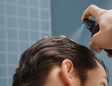 Scalp Reduction Surgery: How Does It Work? | Ro