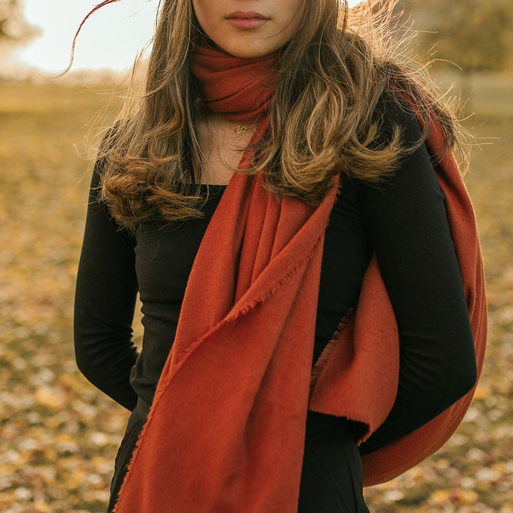 Hickeys: How to Get Rid of One and How to Give One | Ro