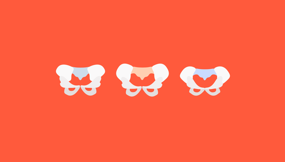 Do You Know What Your Pelvis Type Is? | Ro